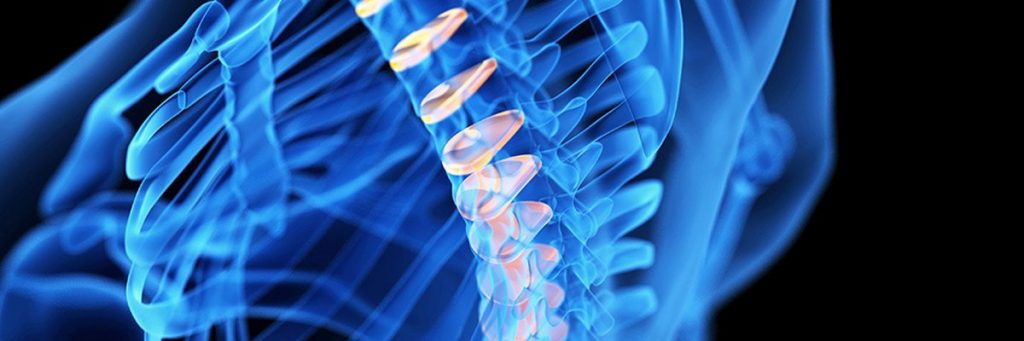 Spinal Instability | Lumbar Instability | NSPC Brain & Spine Surgery